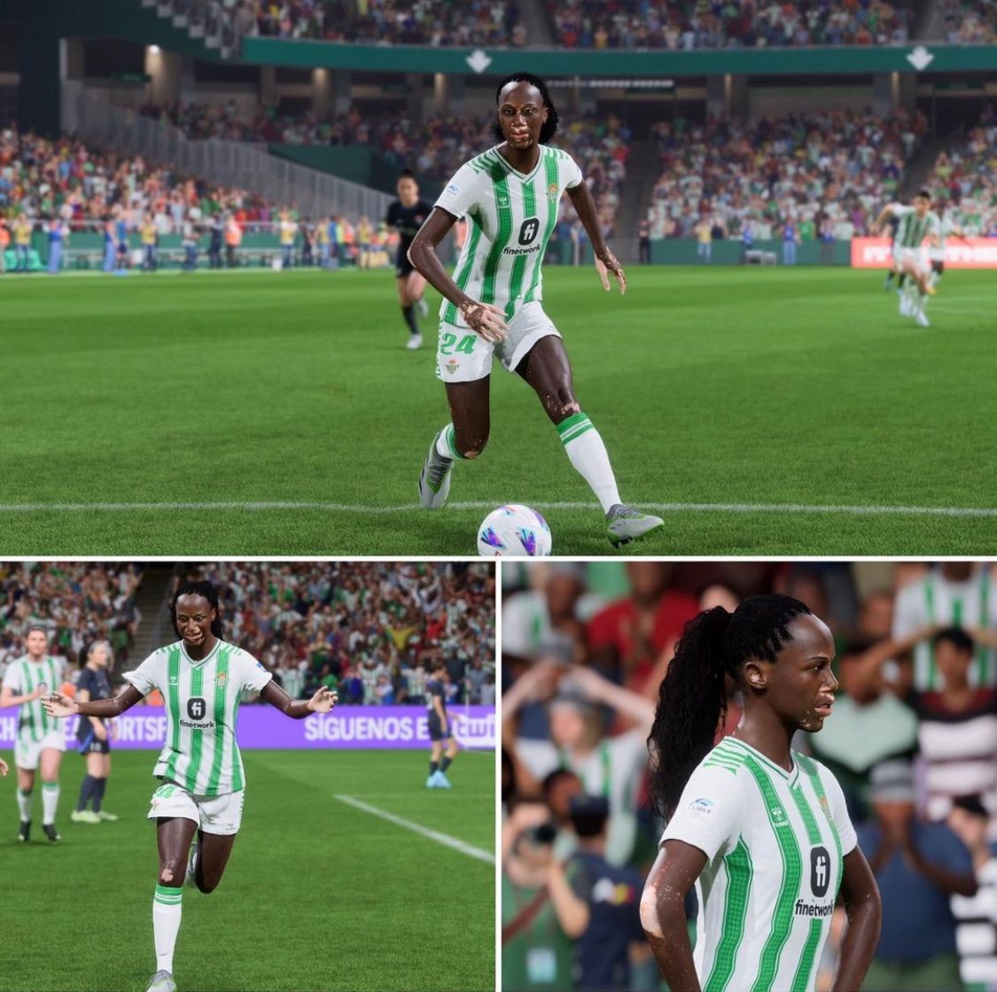 Tiffany Cameron proud to represent vitiligo community in EA FC