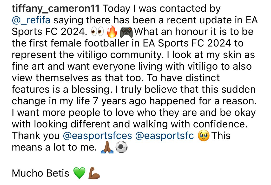Tiffany Cameron proud to represent vitiligo community in EA FC